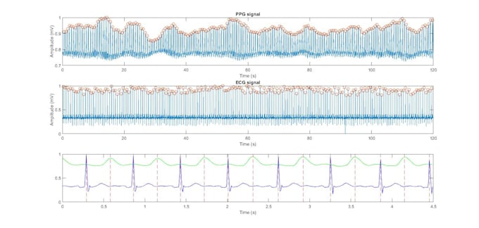 Do Biomedical Signal And Image Processing By Jessan Fiverr