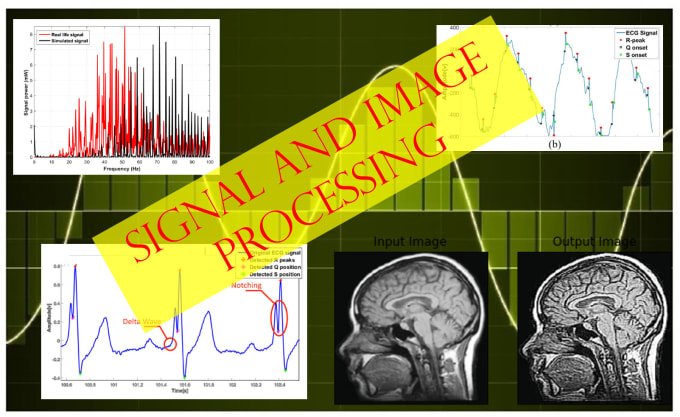 Provide Professional Image And Signal Processing Services With Matlab