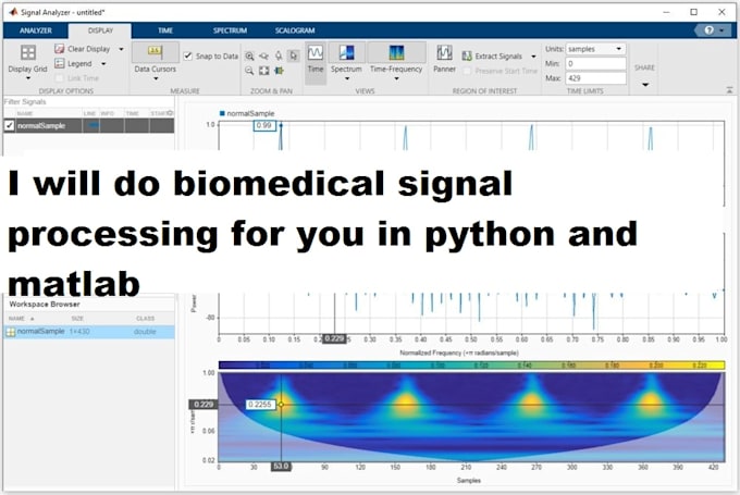 Biomedical Signal Processing For You In Python And Matlab By