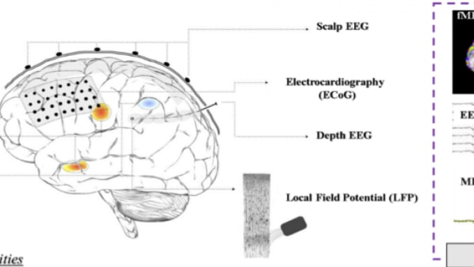Do Biomedical Image Processing Signal Processing In Python By