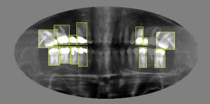 Do Image Annotation Data Labeling Bounding Box Segmentation By