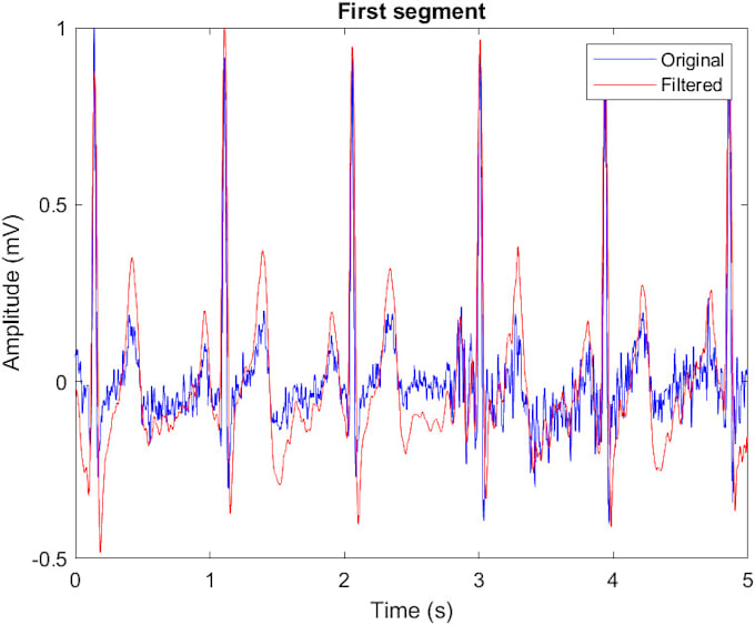 Do Biomedical Signal And Image Processing By Jessan02 Fiverr