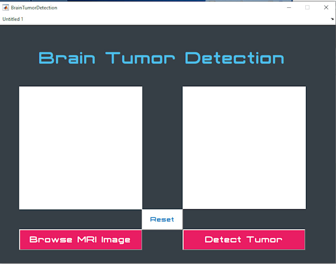 Do Classification For You On Matlab Using Cnn And Svm By Iamalihamza
