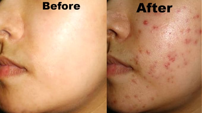 Photoshop editing,clean face,image resize,remove background by ...