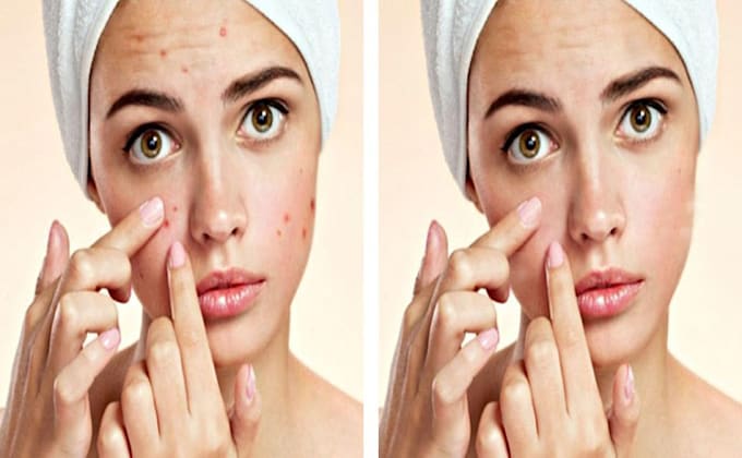 Do acne remove, background removal, cut out images by Saniulalam | Fiverr