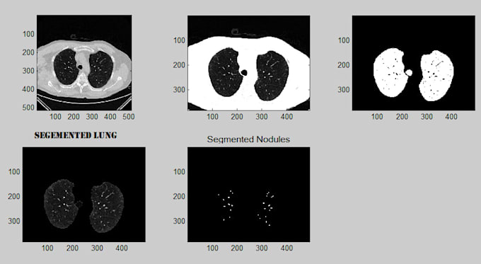 Do matlab,python tasks on image processing, cv, engineering by ...