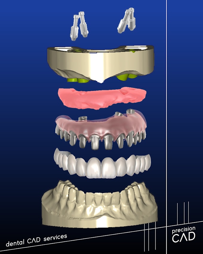 Turn your scans into dental designs using exocad by Precisioncad | Fiverr