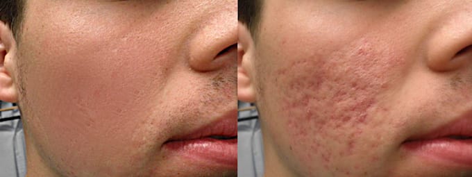 Fix skin flaws in your photos by Karimkiyoo | Fiverr