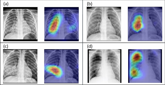 Do medical image classification, segmentation, and detection by ...