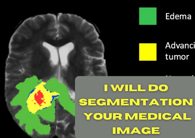 Medical image segmentation using unet algorithm by Saidjadidi | Fiverr
