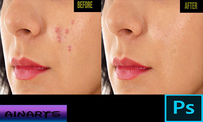 Retouch, enhance and remove pimples from your images by Ainarts | Fiverr