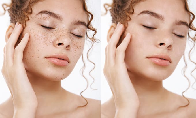 Retouch any acne, pimple, or dark spots on photoshop by Atifhavanor ...