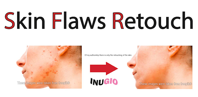 Do skin flaws retouch by Inugio | Fiverr