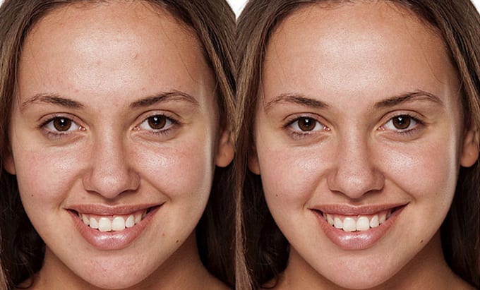 Clean your face, smooth skin and remove blemishes and scars by ...