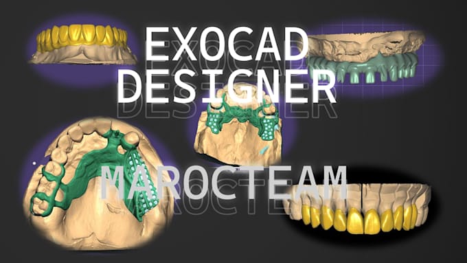 Design crowns,bridges, implants, partial, using exocad by Marocteam ...