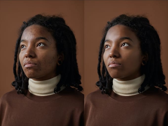 Can improve the skin, increase or remove the elements by Salmonuwu16 ...