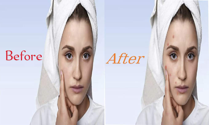 Do photo editing, and face retouching and skin retouching and portraits ...