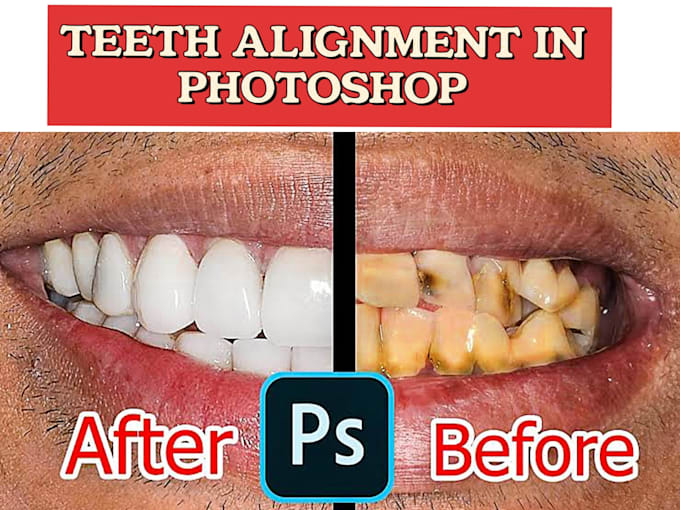 Whiten teeth, fix and align them using photoshop by Noorfatima44 | Fiverr