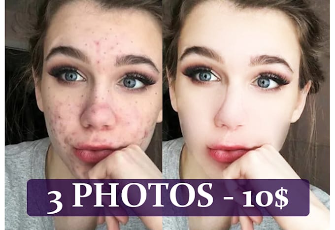 Face retouching, correction, removal of impurities by Cziqiwork | Fiverr