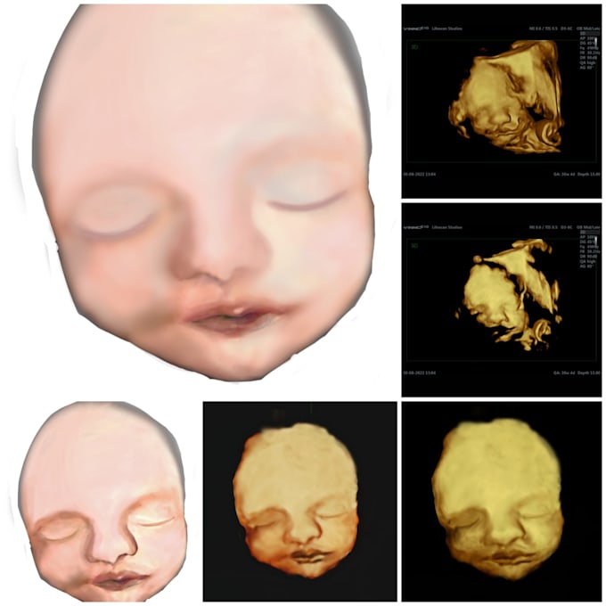 Upgrade your 3d and 4d baby scan photos by Cree84u | Fiverr