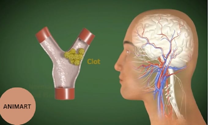 Create healthcare or medical 2d animated explainer video by Animart01 ...
