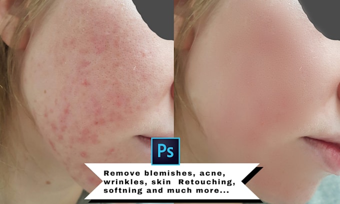 Do skin retouch, photo retouching, photo editing, and photo enhancement ...