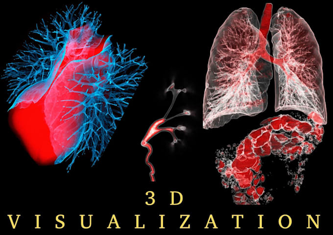 Create a medical 3d animation based on your ct or mri dicom by ...