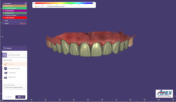 Upgrade your dental smile cases to max level using exocad software by ...