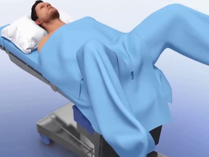 Create realistic 3d medical animation, 3d medical video with 3d ...