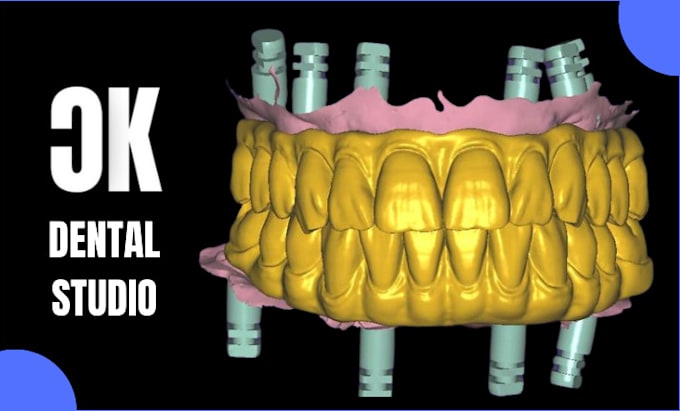 Professional digital tooth design by Cankilicaslan | Fiverr