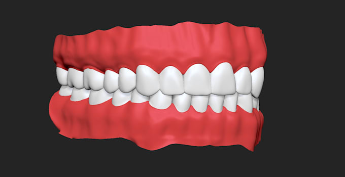 Create 3d medical animation, surgery animation, dental 3d animation ...