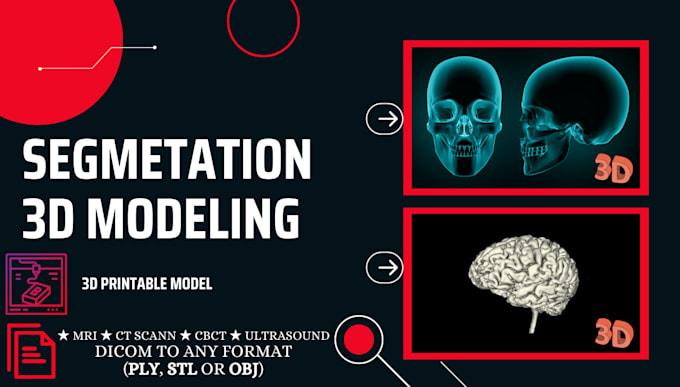 Create a 3d model from your mri or ct scan dicoms by Zakariae101 | Fiverr