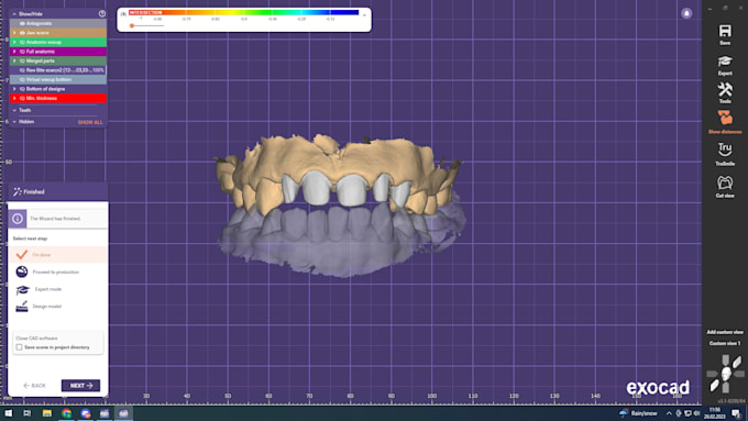 Design premium crown , bridges , mockups with exocad by Sandorkovcs ...