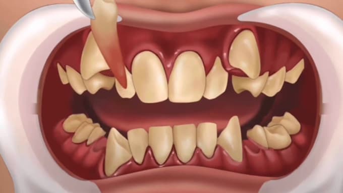 Super quality 3d medical animation , 3d dental animation video with hd ...