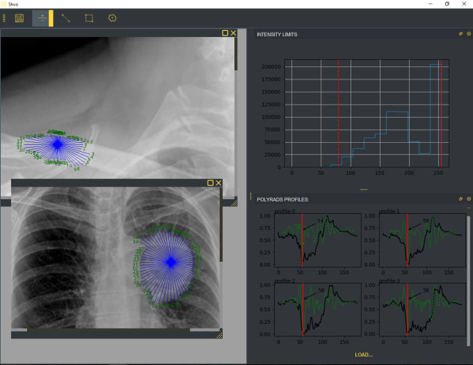 Code everything related to image processing and computer vision in ...