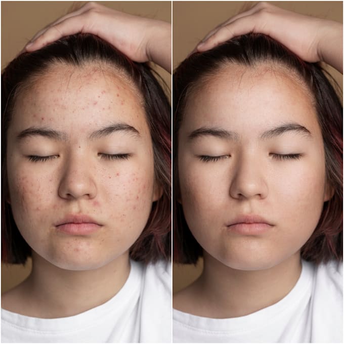 Remove blemishes and make other changes to improve the appearance of ...