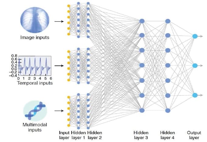 Perform tailored nlp topic detection by Tdecae | Fiverr