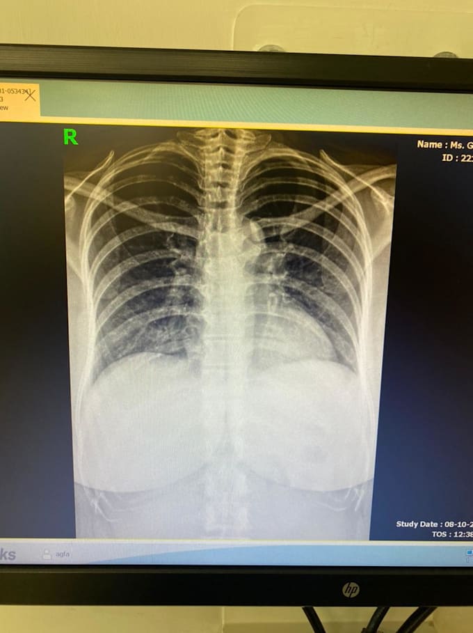 Online report your x rays ct scans and mri by Aamirraja1 | Fiverr Online report your x rays ct scans and mri by Aamirraja1 | Fiverr