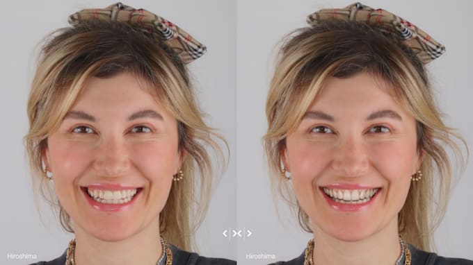 Professional digital smile design dsd by Cankilicaslan | Fiverr