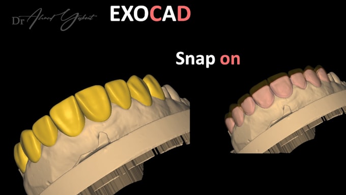 Design snap on smile by Yakout97 | Fiverr