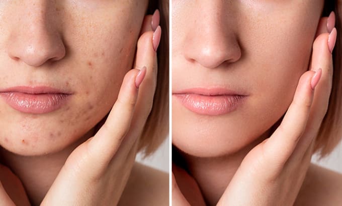 Do natural beauty photo retouching by Rocetera | Fiverr