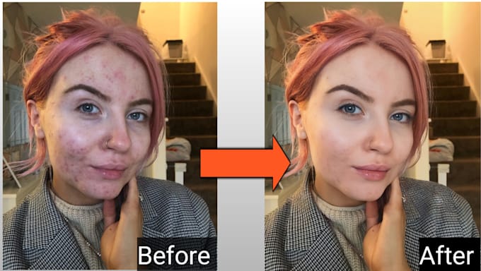 Professionally headshot retouch, skin, portrait photo with high end by ...