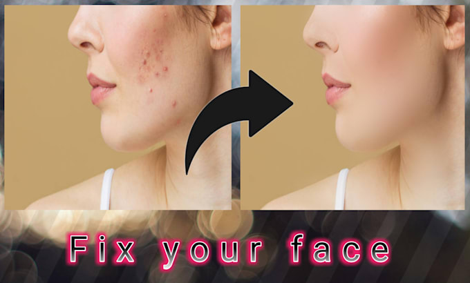 Fix your face, remove acne and freckles on the face by Diliya__officia ...