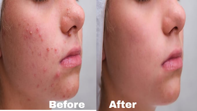 Do skin, beauty retouching, pimples, wrinkles and soften by ...