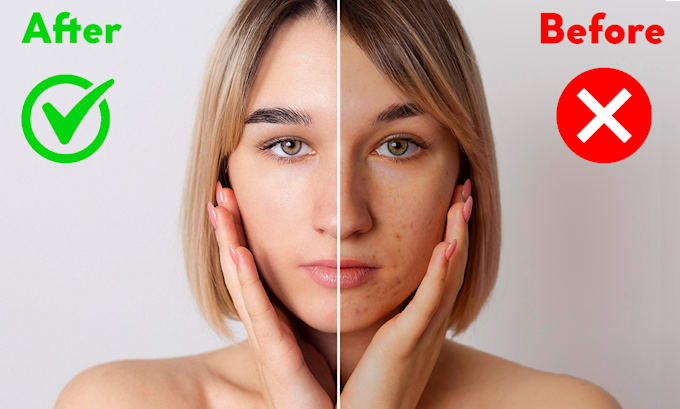 Do face retouching, skin retouching, remove pimples in 12 hours by ...