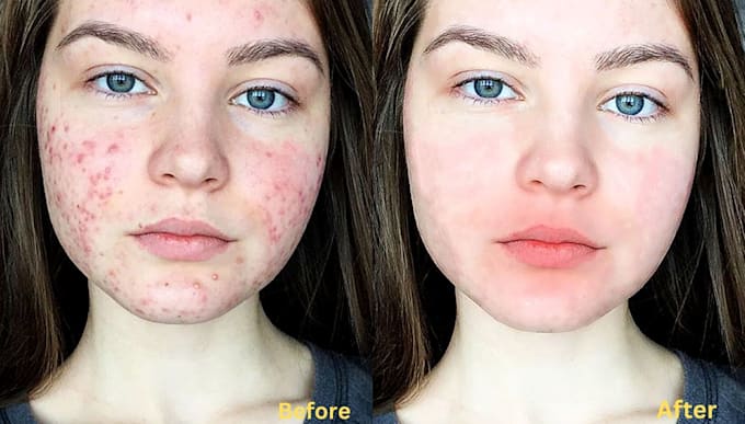 Retouch beauty high end fashion portrait photo retouching by Skillcraft ...