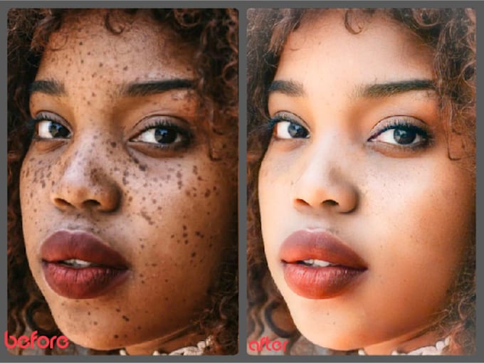 Remove freckles from your face incredibly unbelievable by Shansasanka ...