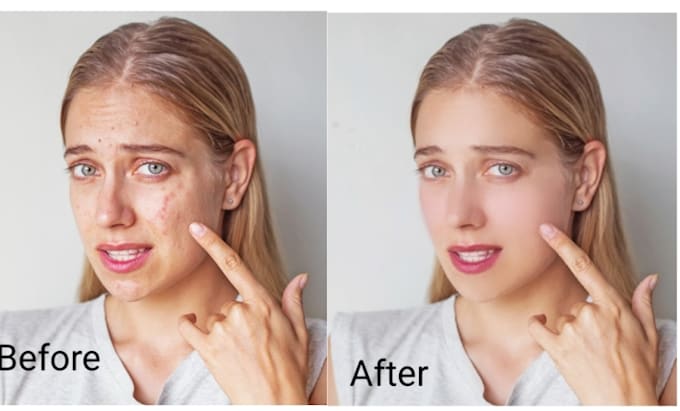 Do retouching scar removing and image editing by Ransagig | Fiverr Do retouching scar removing and image editing by Ransagig | Fiverr