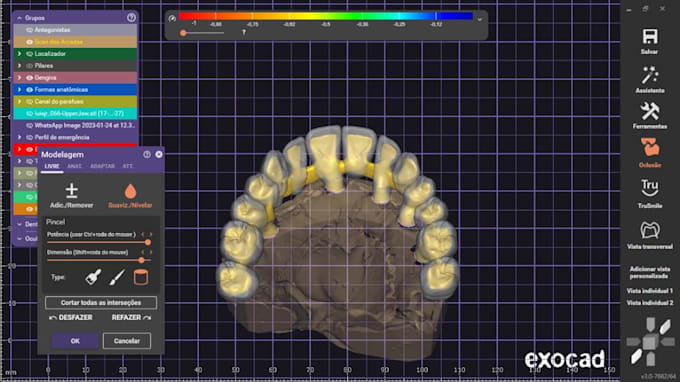 Design almost everything exocad supports by Luis_foroni | Fiverr