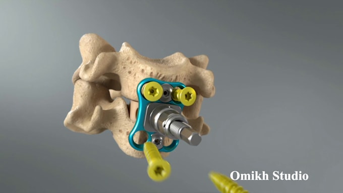 Create medical animation 3d medical product design 3d medical device ...